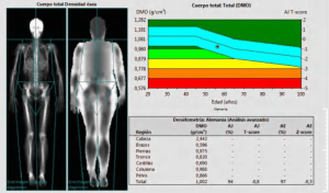 Qué es un Análisis de Composición Corporal | Centro Diagnostico